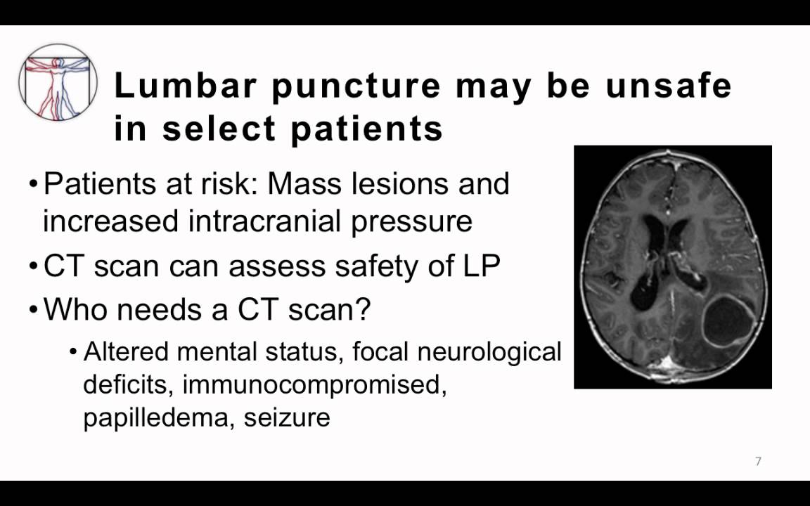Lumbar Puncture Meningitis