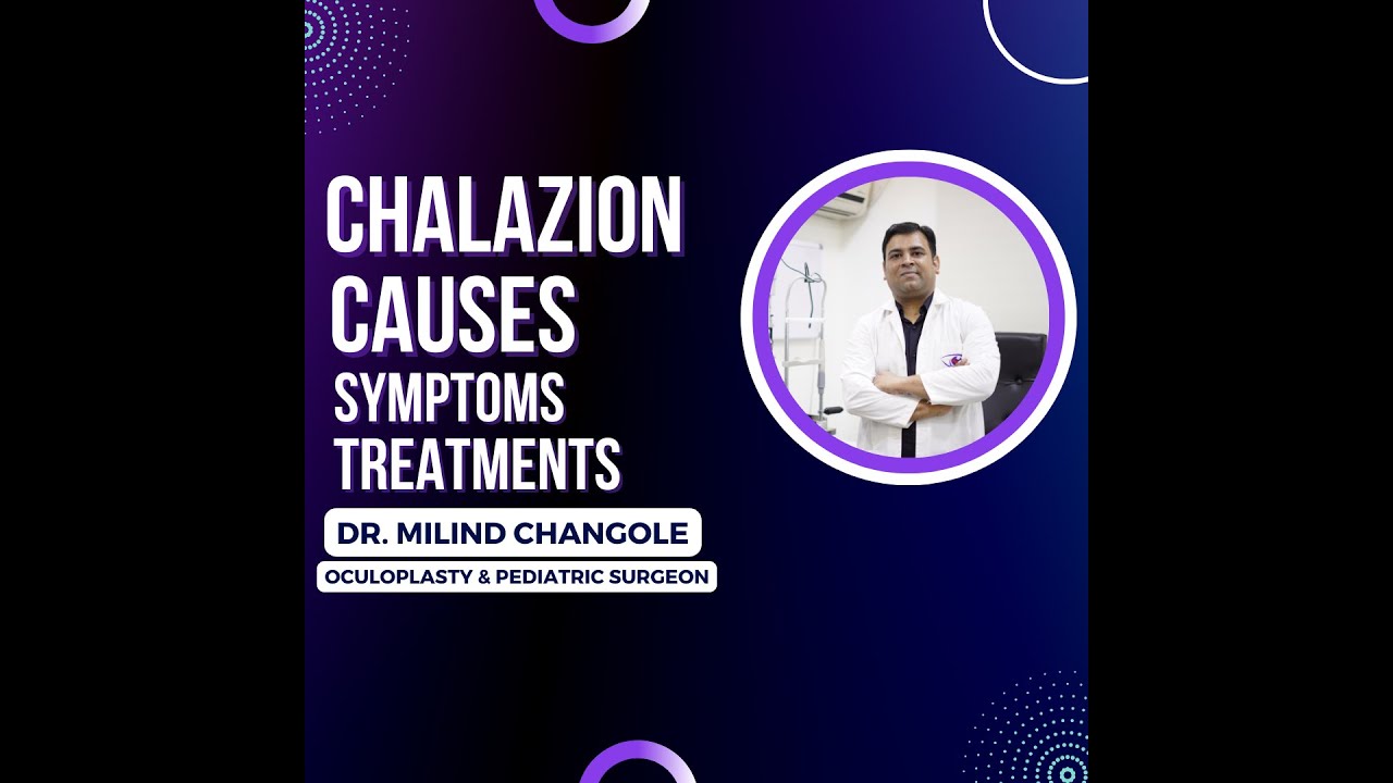 Say Goodbye to Chalazions: A Comprehensive Guide to Treatment and ...