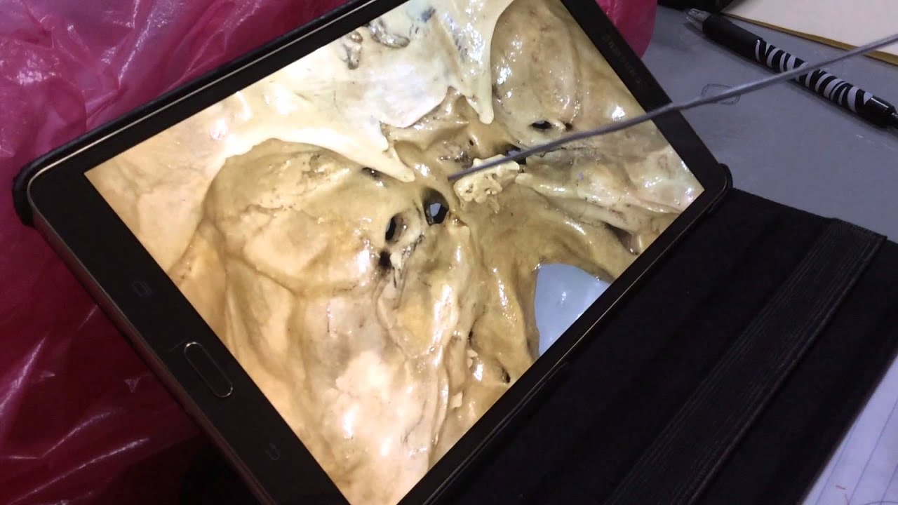 ANATOMIA ENDOCRANEAL - YouTube