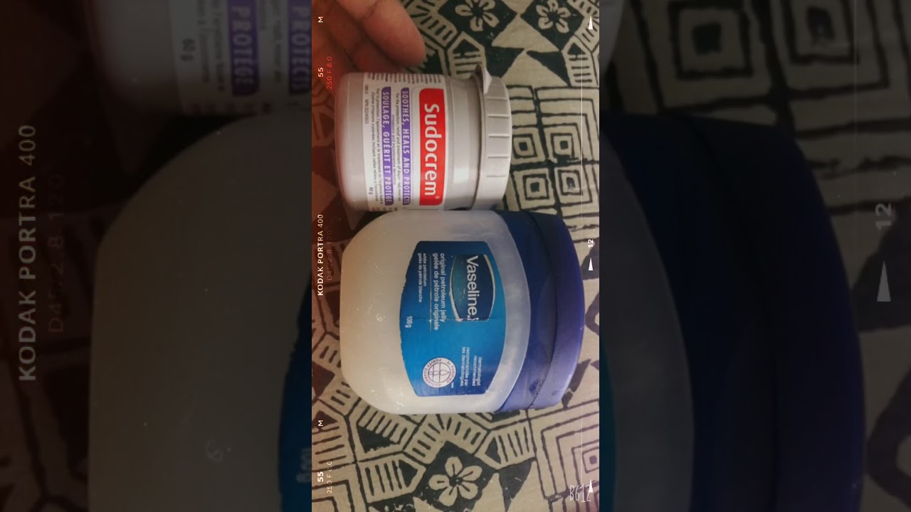 Two effective Diaper rash resolve 🙀 - YouTube