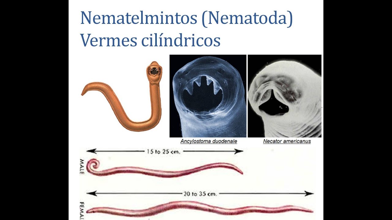 Doença Causadas Por Nematelmintos