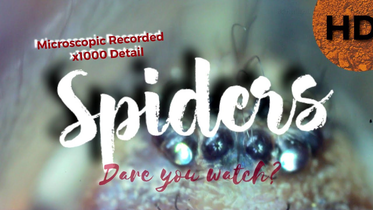 Dare you watch? English Spiders HD & magnified up to x1000. Rainbow ...
