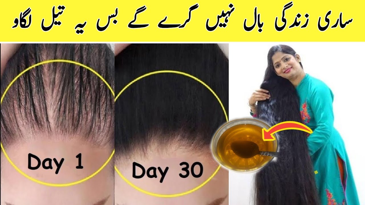 Fast hair growth | how to grow long and thick hair | hair growth tips ...