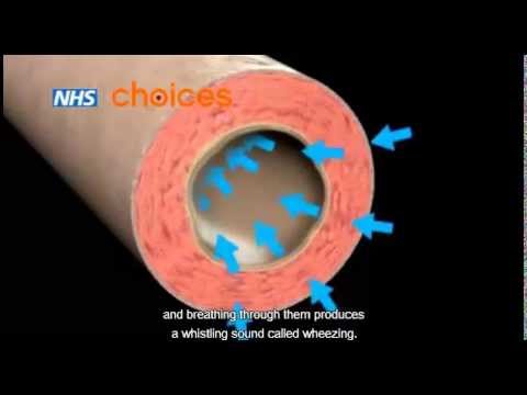 asthma | asthma pathophysiology | lung disease | weeze | wheezing ...