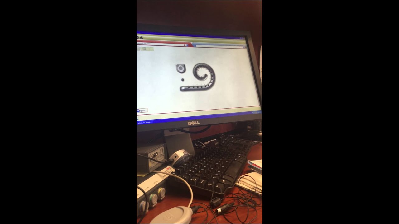 Cochlear Implant Mapping Part 1 - YouTube