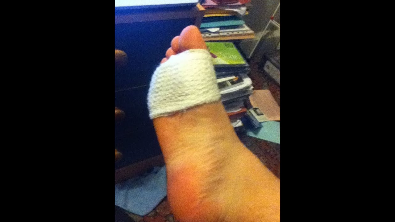 My Worst Injury (Ghosts Gameplay Commentary) - YouTube