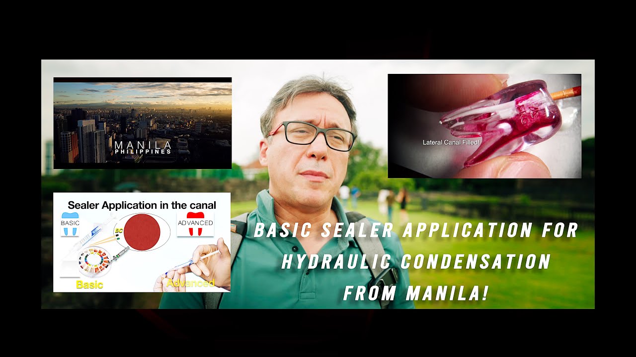 Basic and Advanced Hydraulic Condensation from Manila - YouTube