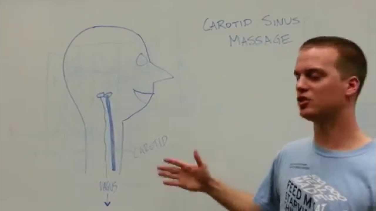 Carotid Sinus Massage Youtube