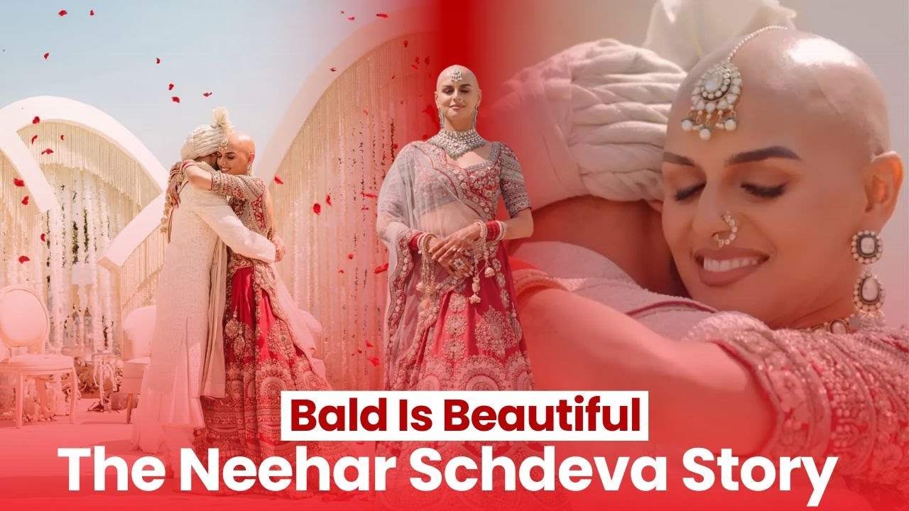 Bald And Beautiful Neehar Sachdeva | कहानी निहार की, निहारते रह जाओगे ...