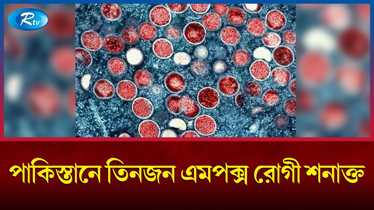 সুইডেনের পর, এবার নতুন করে পাকিস্তানে তিনজন এমপক্স রোগী শনাক্ত ...