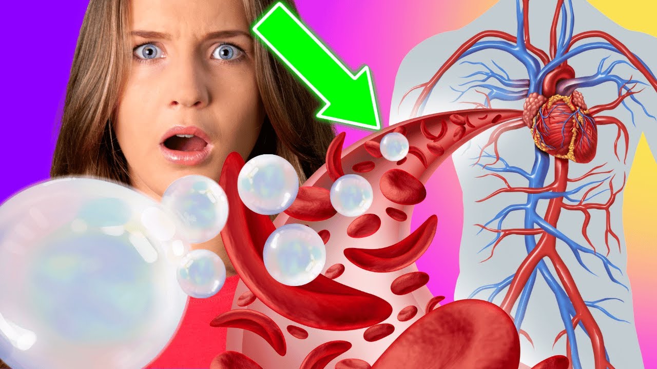 Enlarged Fat Cells in Obesity Can IMPROVE Heart Health in Some Cases ...