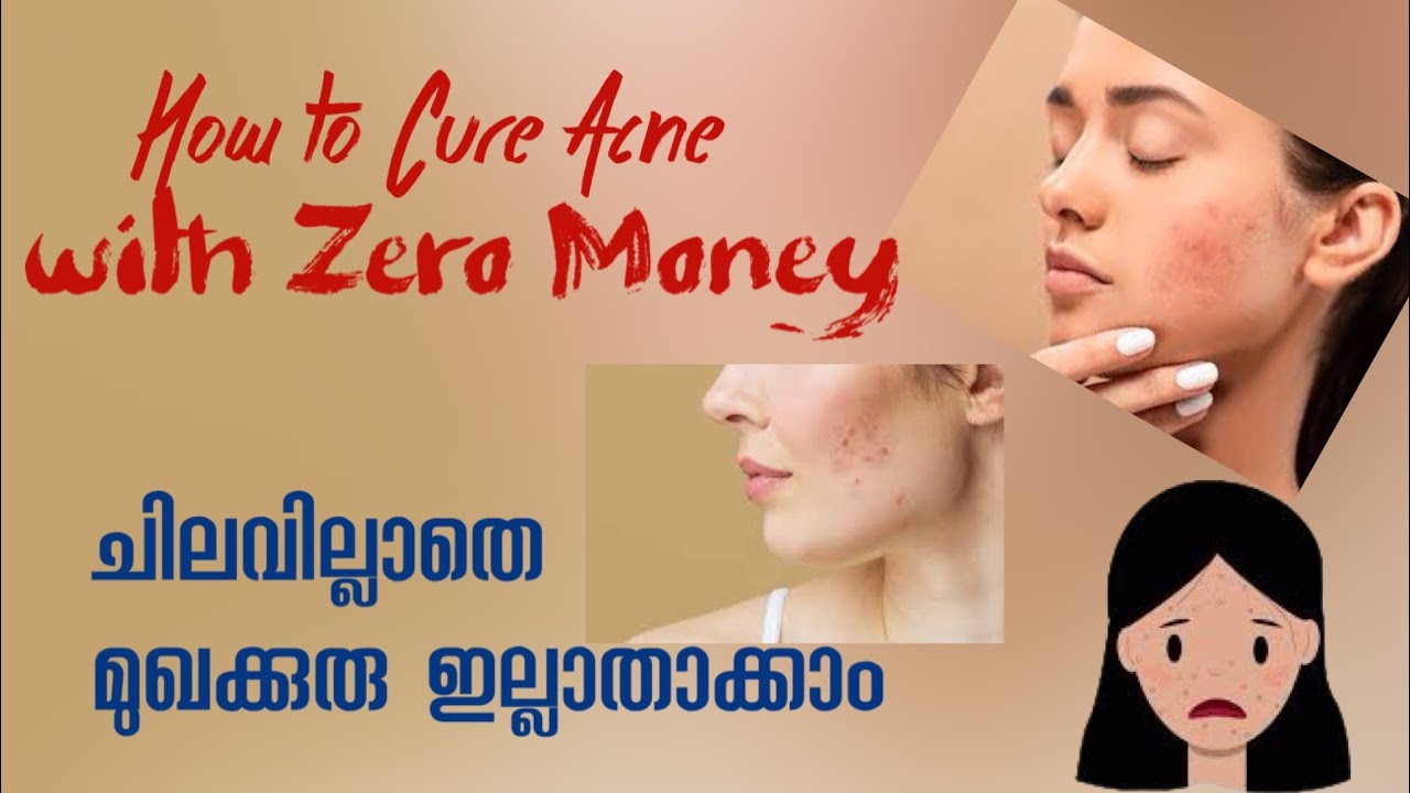 Home Remedies for Acne | How to Cure Acne with Zero Money | Home Remedy ...
