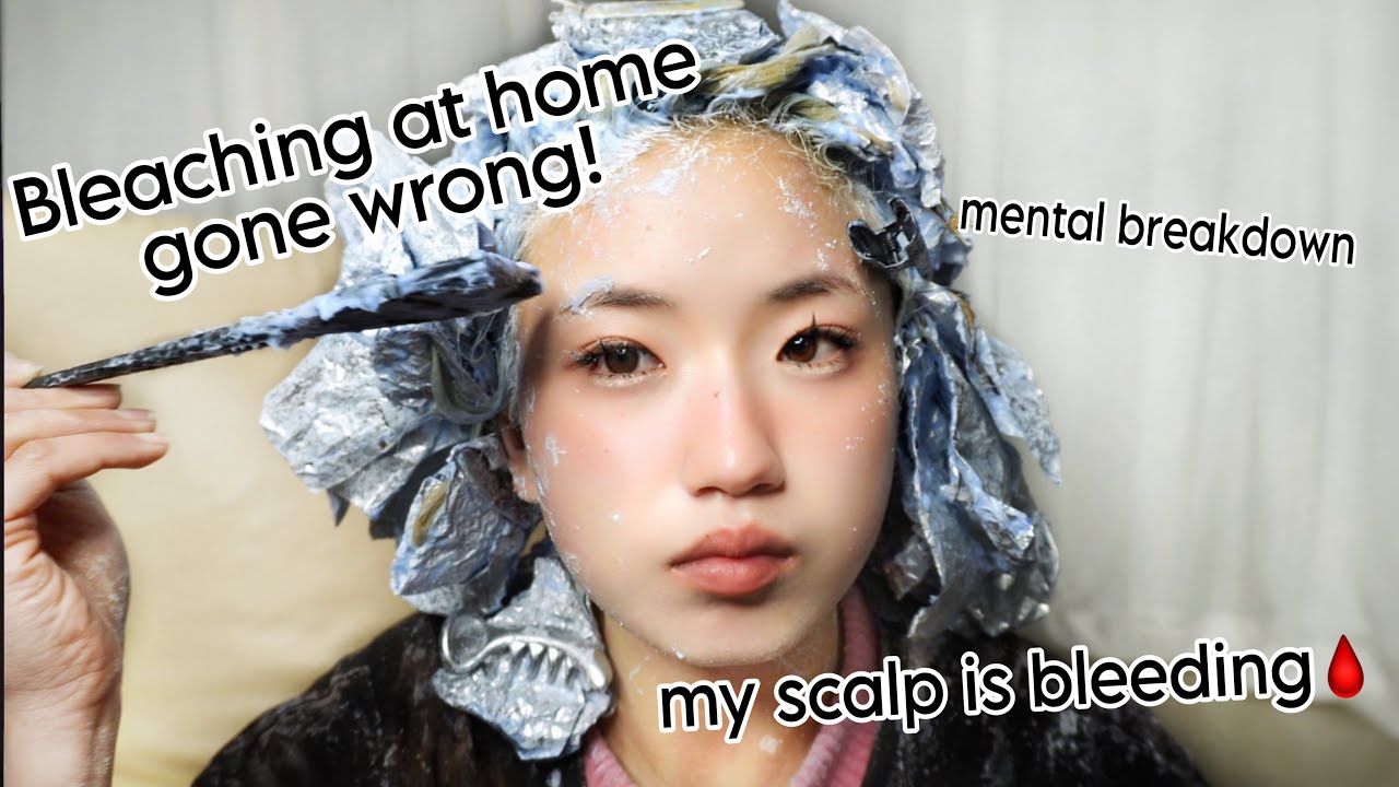 BLEACHING MY HAIR AT HOME WENT HORRIBLY WRONG!(bleach burn,blood, scabs ...