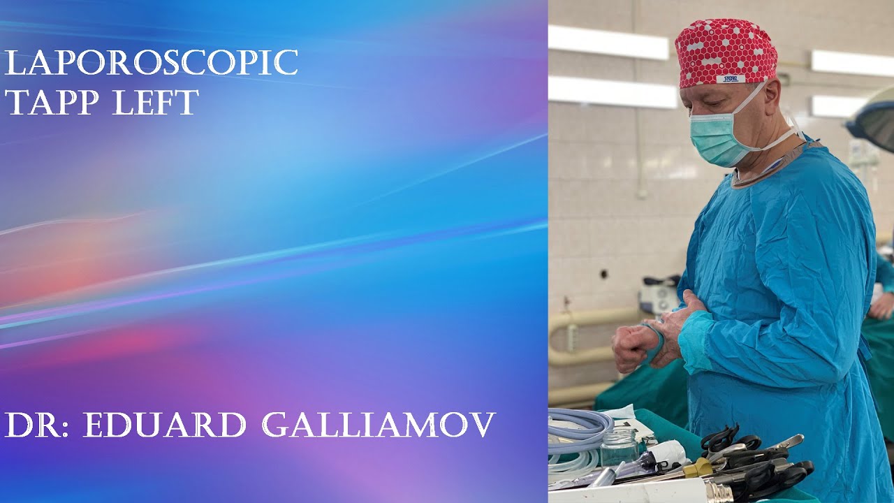 Laparoscopic TAPP left / Левосторонняя лапароскопическая герниопластика ...