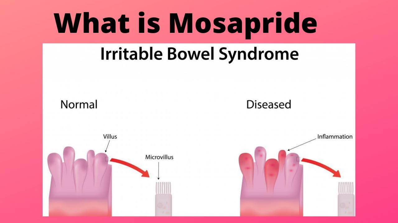 What is Mosapride - YouTube