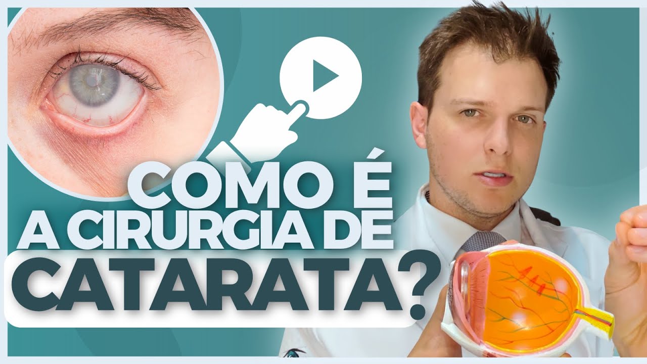 Como é a Cirurgia de Catarata - YouTube
