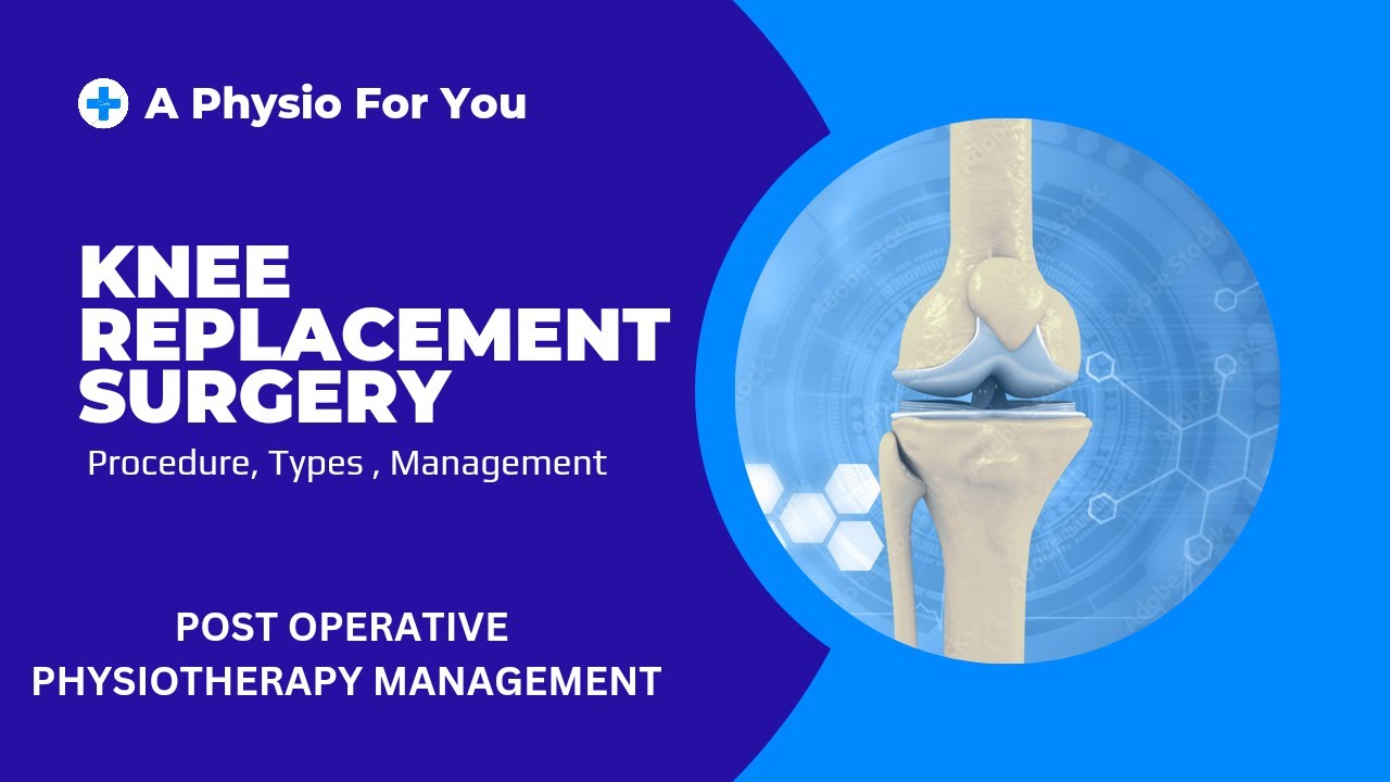 Knee Replacement | Step by step Explained | With Physiotherapy ...