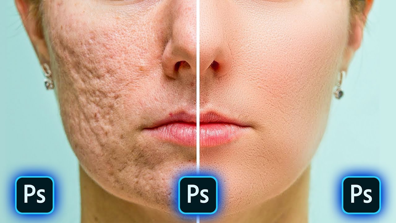 Photoshop Tutorial How to Quickly Skin Smooth and Remove Scars ...