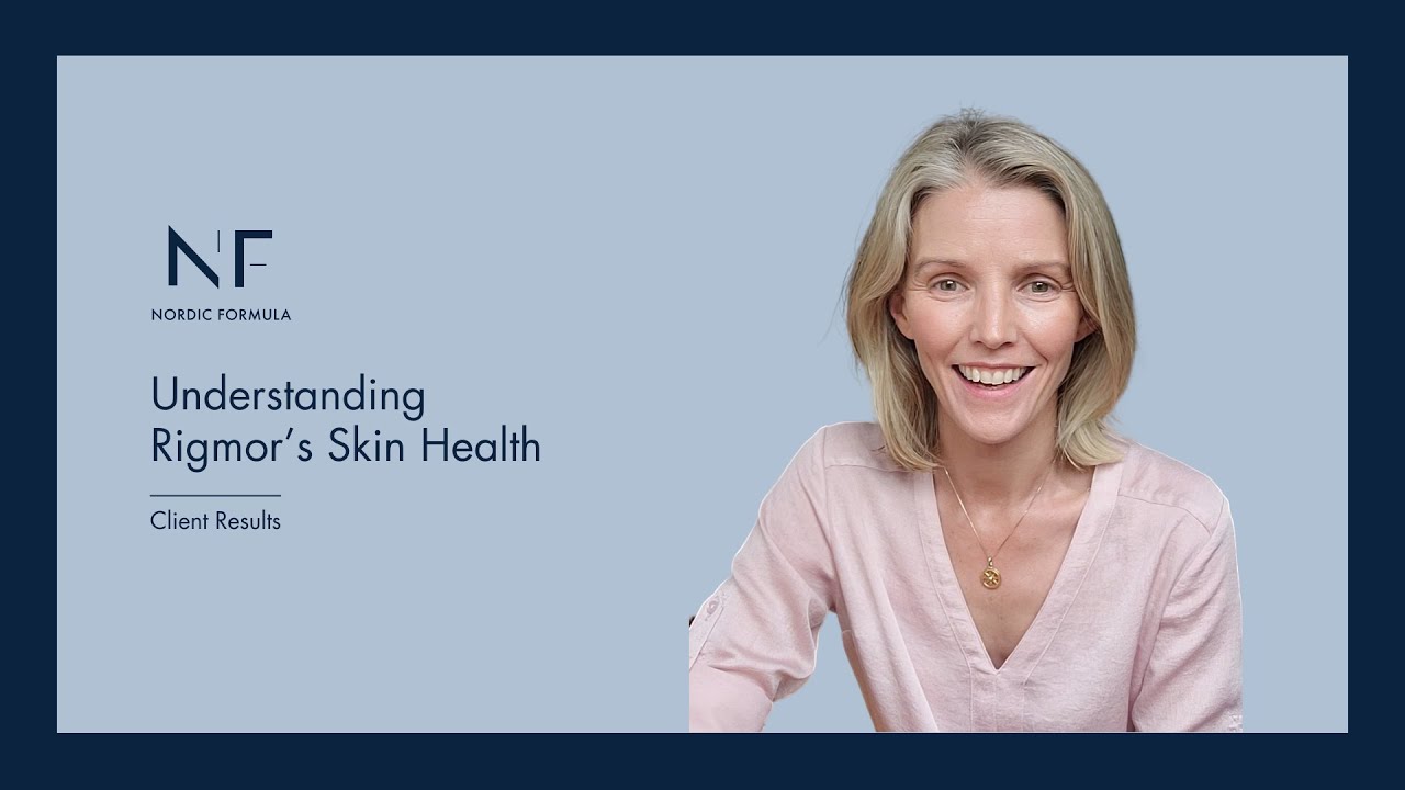 Nordic Formula Linda explains Rigmors Skin Results - YouTube