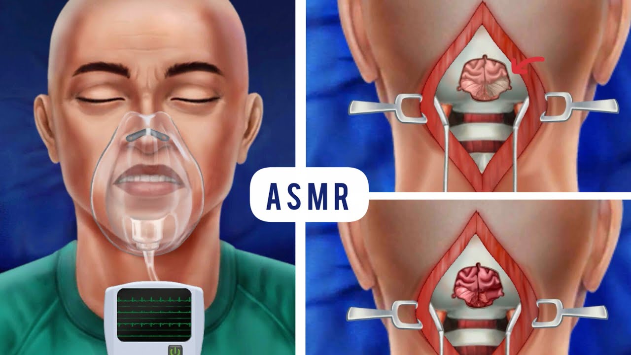 ASMR How to best treatment An extremely sensitive procedure need your ...