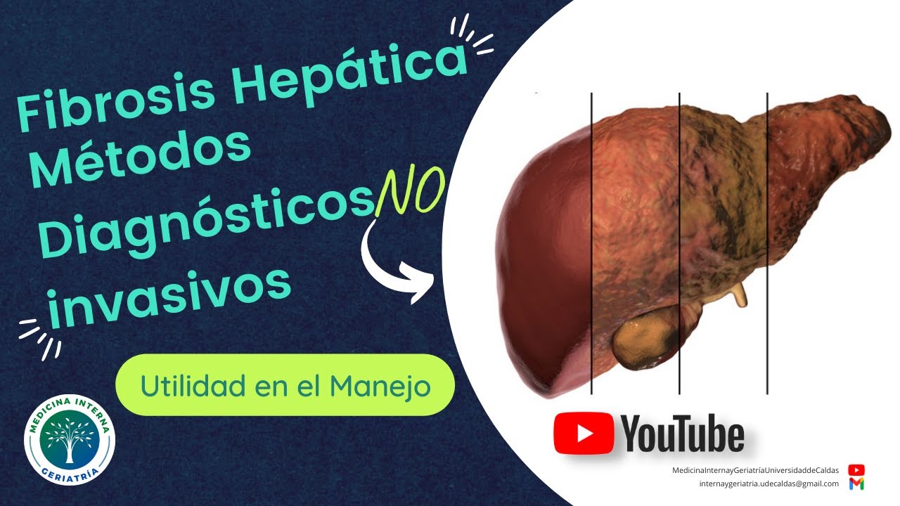Fibrosis Hepática Métodos Diagnósticos no invasivos en el 2023 ...