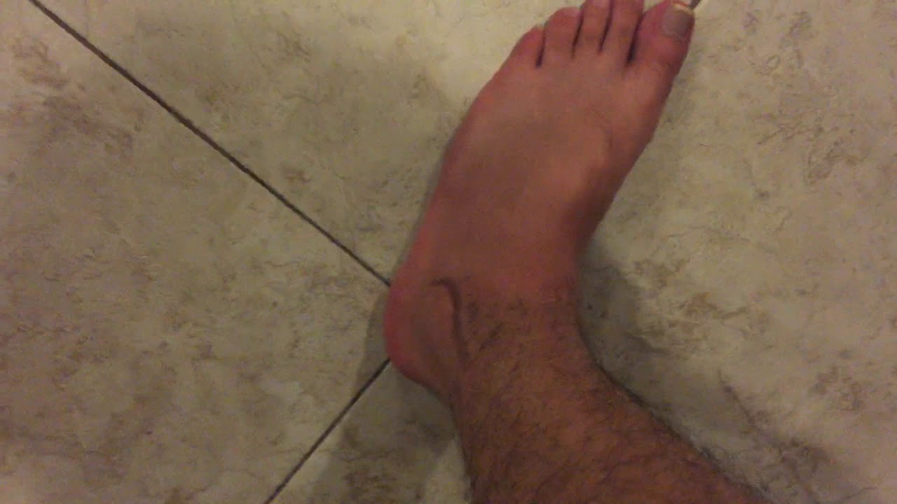 ejercicios rehabilitacion tobillo rotura perone fisioterapia online ...