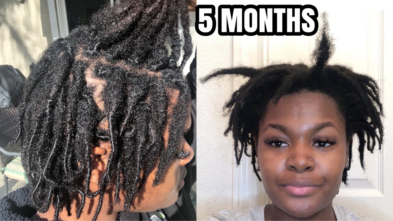 5 Month Loc Update with Pictures | What They Don't Tell You About Locs ...