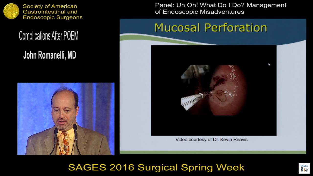 Complications after POEM - YouTube