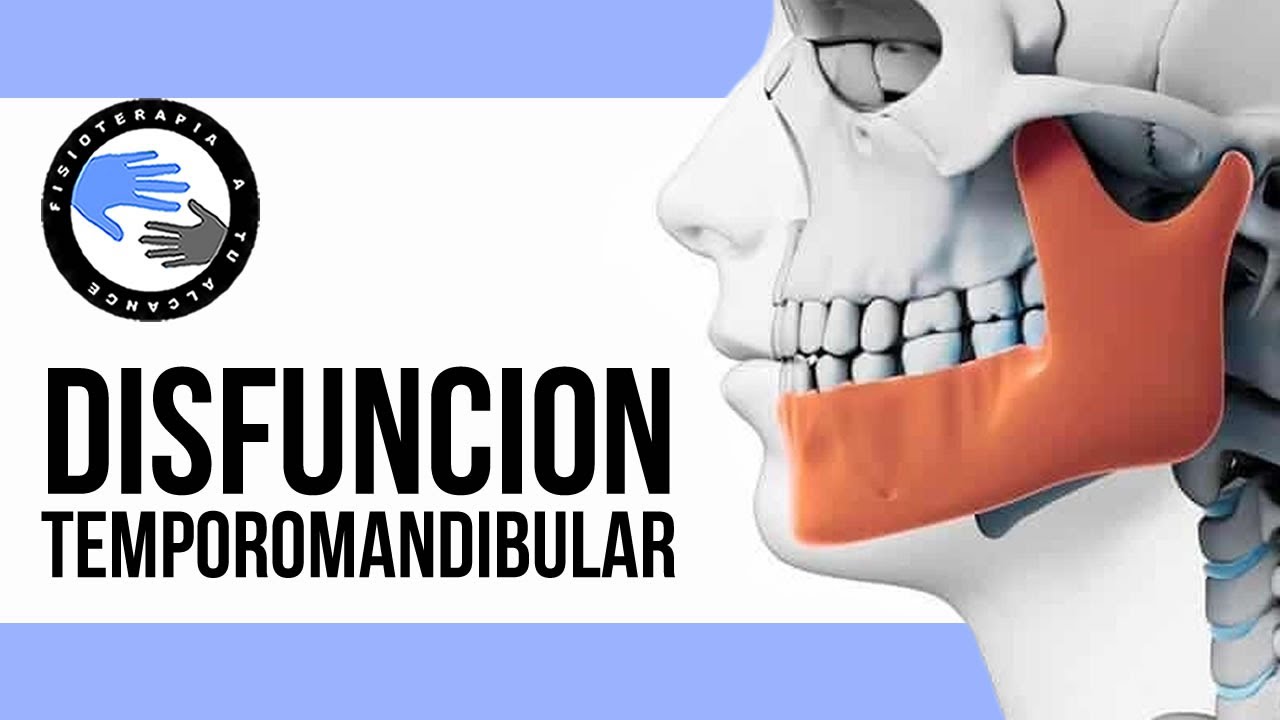 Luxación Y Subluxación Mandibular O De La Atm: ¿Qué Es Y Qué – QTWWM