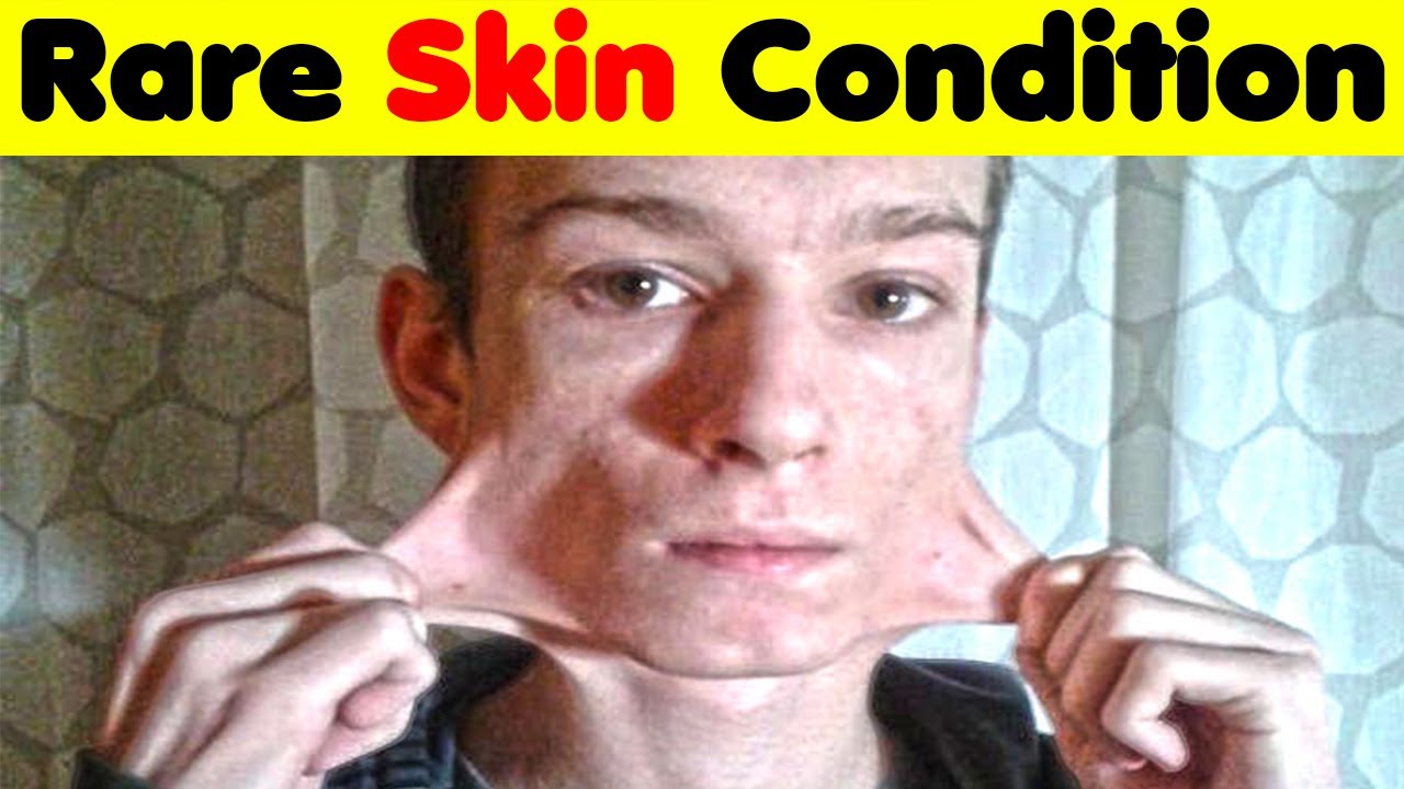 People With The Most Interesting Body Features - YouTube