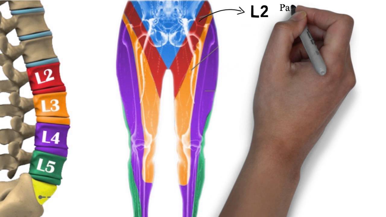 Symptoms of Sciatica - YouTube