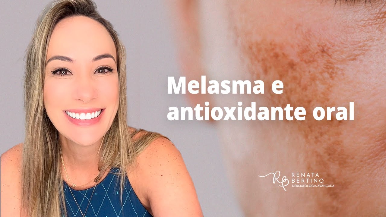 Melasma e protetor solar oral - YouTube
