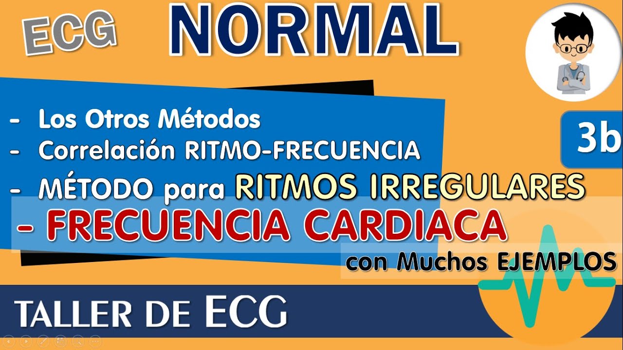 Frecuencia Cardíaca en RITMOS IRREGULARES, Los OTROS MÉTODOS, Casos ...