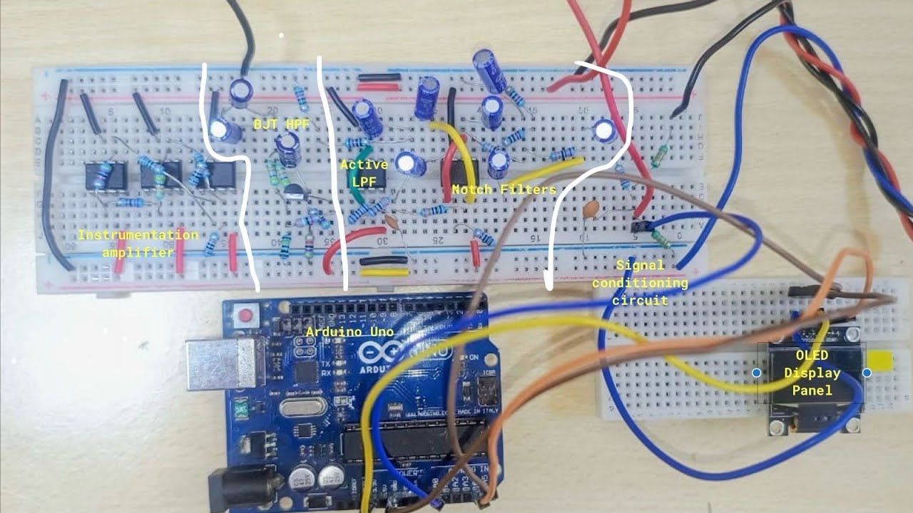 3 Lead Analog Electrocardiogram (ECG) Project | Circuit Working ...