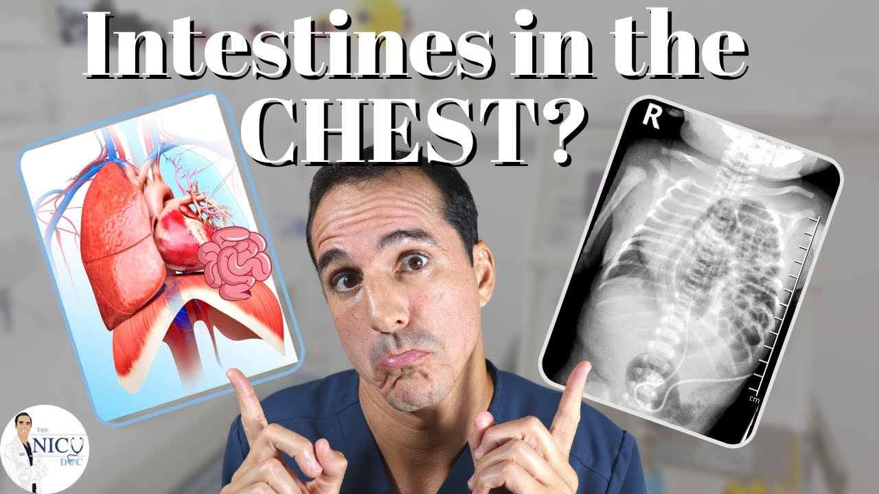 What is CDH - YouTube