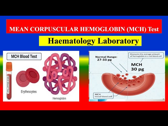 Mean Corpuscular Hemoglobin Definition Of Mean