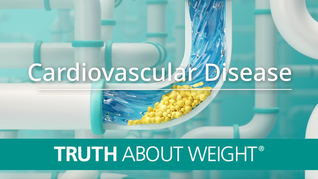 Heart Disease and Excess Weight – Get the Inside Truth - YouTube