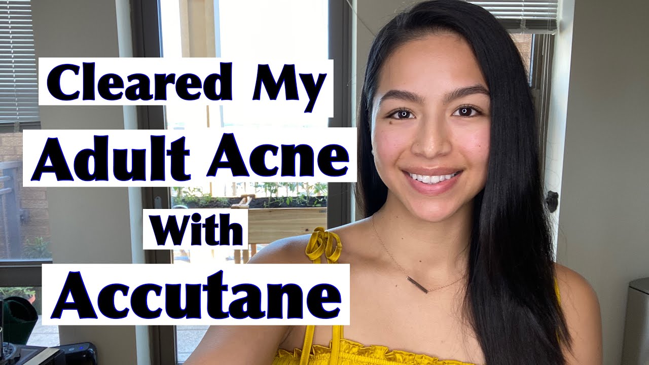Cleared my Adult Acne with Accutane - YouTube