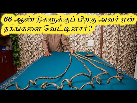 What Happened To his Nails?? || Longest Nail in the World || Melvin ...