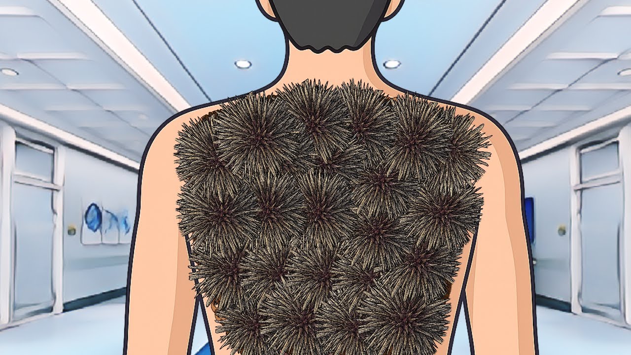 Asmr / Watch this back cleaning bestest animation ever 🤩 - YouTube