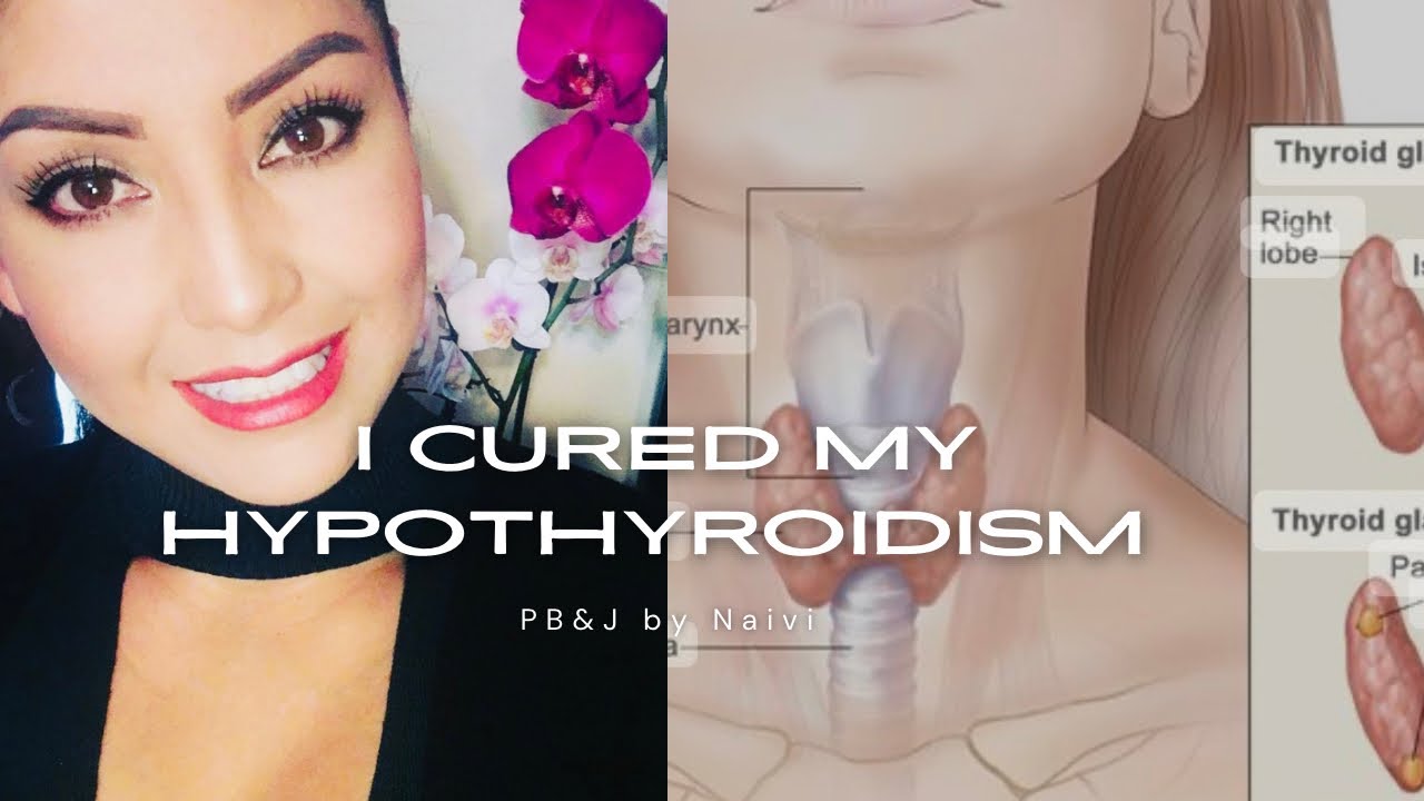 I Cured My Hypothyroidism - YouTube