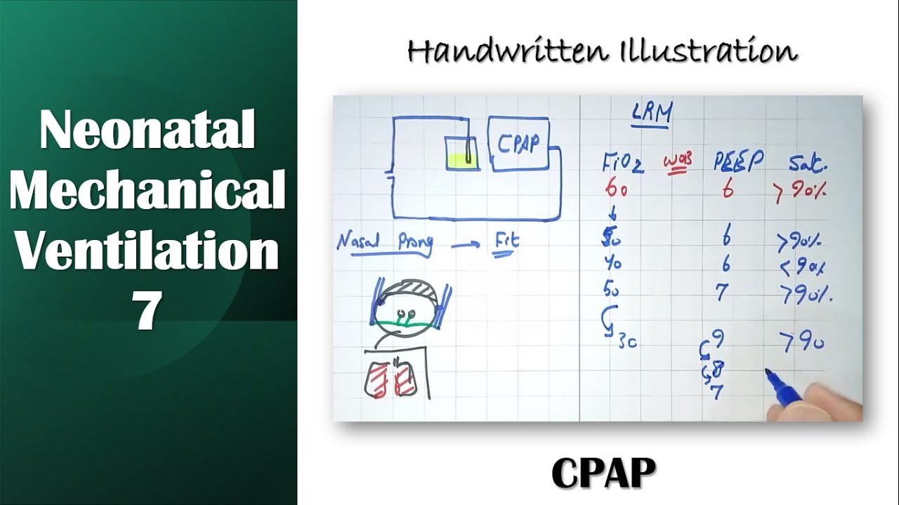 Neonatal Mechanical Ventilation 7 | CPAP | Handwritten illustration ...
