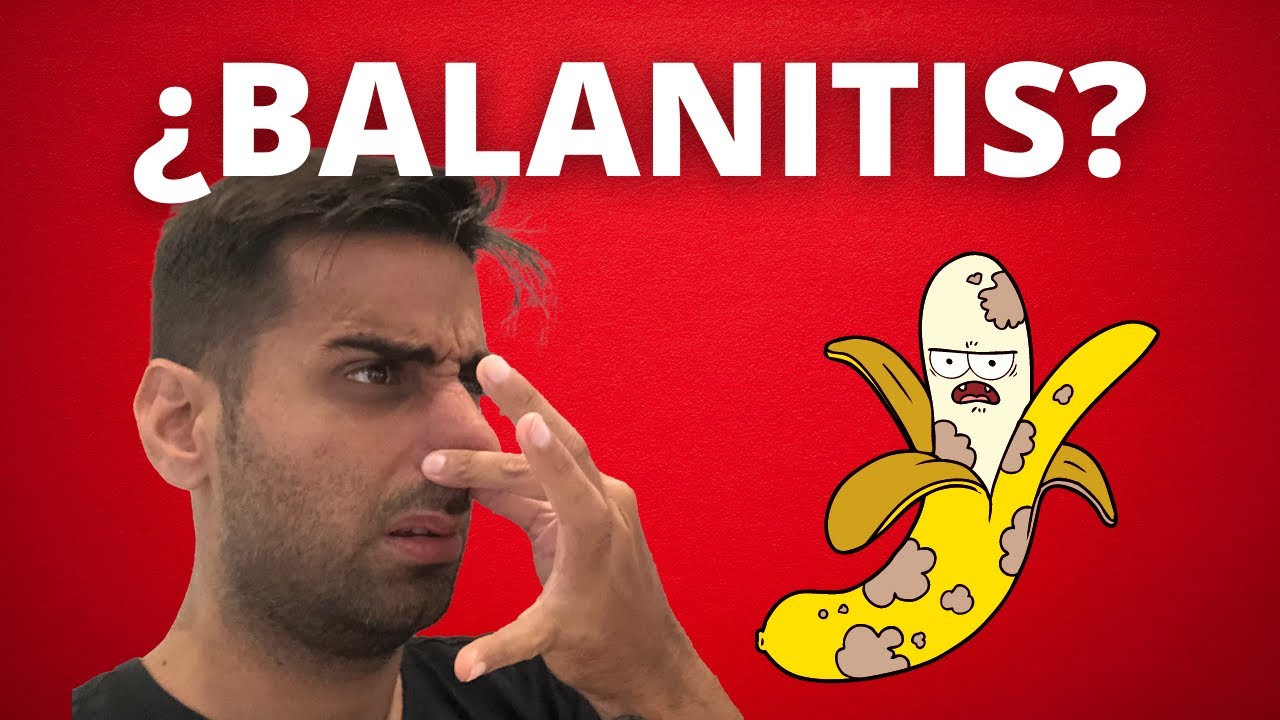 Cómo Curar La Candidiasis Genital En Hombres [Balanitis] - YouTube