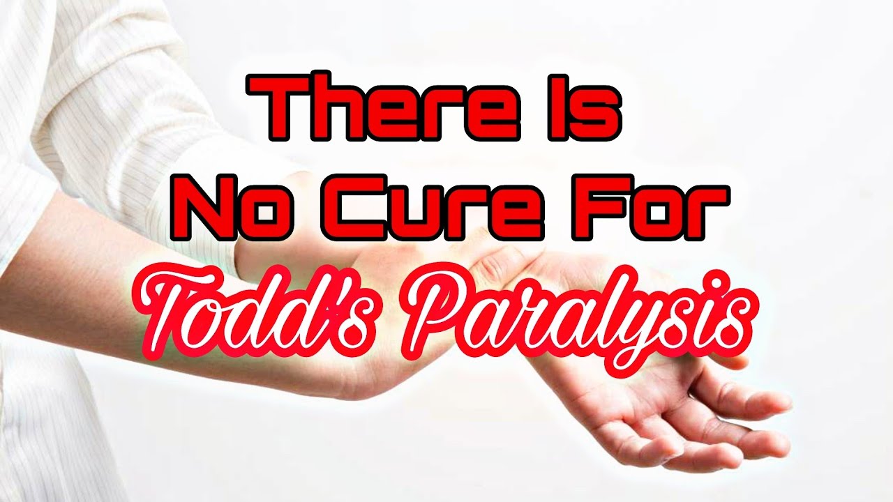 What Is Todd’s Paralysis?|Causes Riskfactors|Symptoms Diagnosis|Pre ...