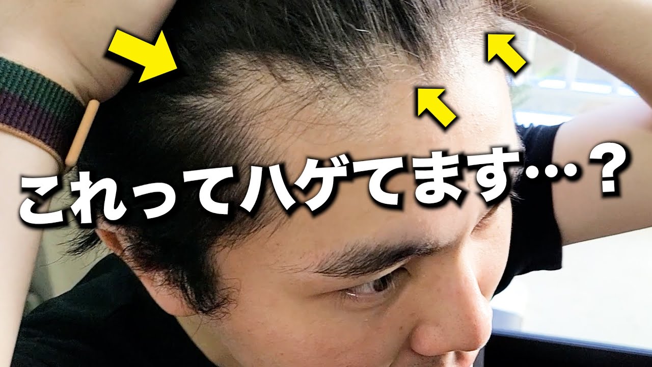 【緊急】これってハゲてます…？ - YouTube