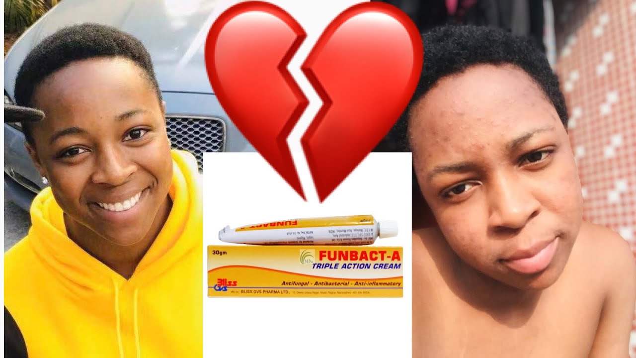 How FUNBACT A ruined 😠 my skin and gave me eczema /my skin cancer scare ...