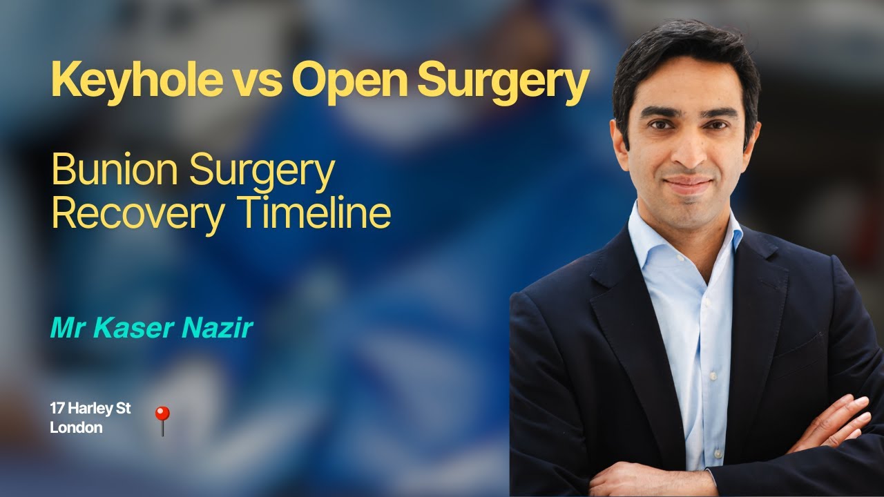 Bunion Surgery Recovery Timeline | Keyhole vs Open Surgery Explained by ...