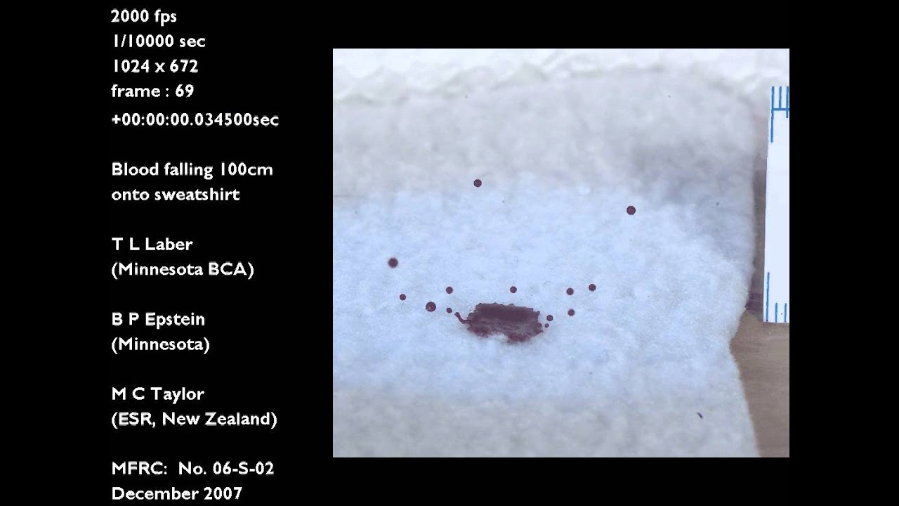 Blood drop falling 100 cm onto sweatshirt | Blood Spatter Analysis ...