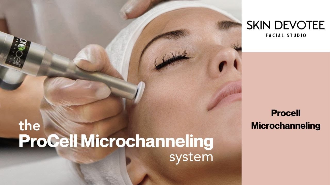 Procell Microchanneling Facial - YouTube