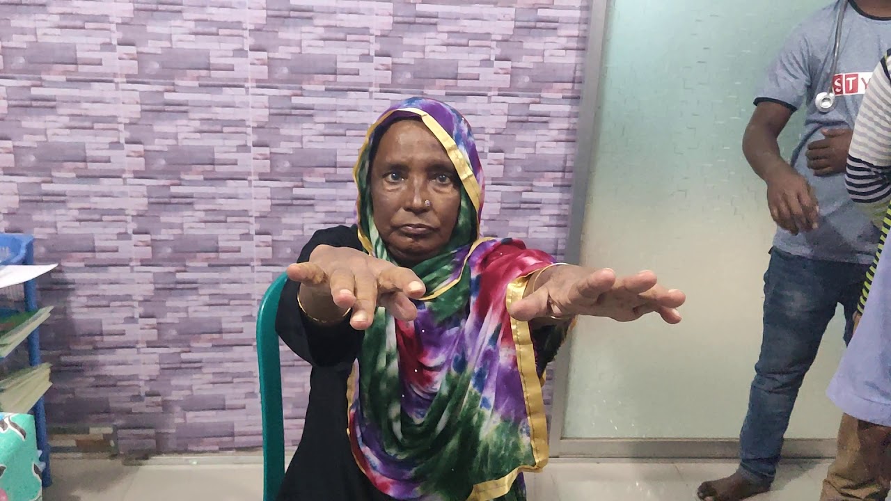 Mononeuritis Multiplex in a patient with Rheumatoid Arthritis - YouTube